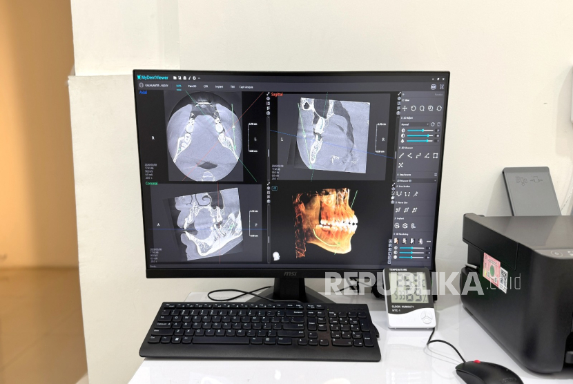 Teknologi CBCT Bantu Dokter Lakukan Diagnosis Gigi Lebih Akurat ...