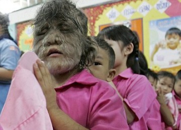 Ilmuwan Temukan Gen 'Werewolf' | Republika Online